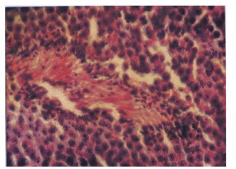 Testis Of Experimental Mouse Exhibited An Increase In The Thickness Of Download Scientific