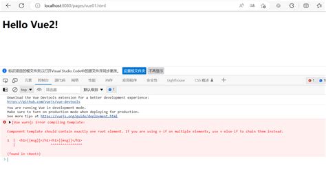 Vue201data插值vue的插值语法获取data Csdn博客
