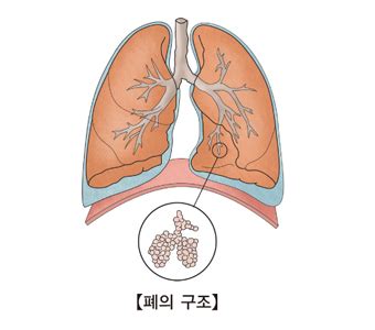 만성 폐질환chronic Lung Disease 질환백과 의료정보 건강정보 서울아산병원