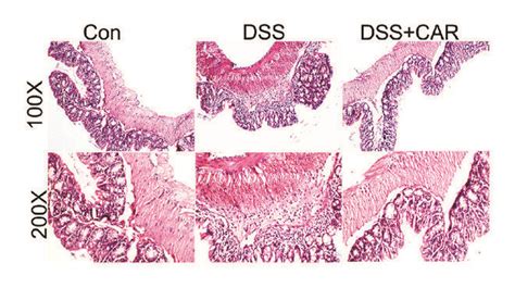 Effect Of Car Overexpression On Dss Induced Ibd Development A Download Scientific Diagram
