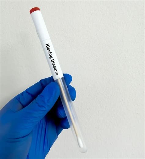 Premium Photo Saliva Sample For Infectious Mononucleosis Mono Test Kissing Disease Caused