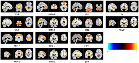 Frontiers Integrating Fmri Spatial Network Dynamics And Eeg Spectral Power Insights Into