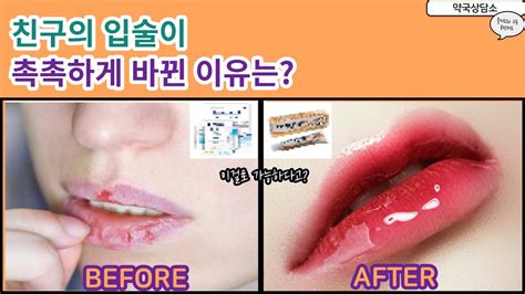 37 상처나고 건조한 입술에 바르는 약사가 추천하는 최고의 립케어 제품 Youtube