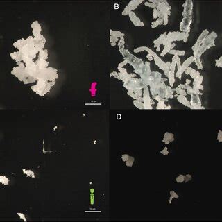 Sex Toy microplastic microscope images all scale bars read µm A Download Scientific Diagram