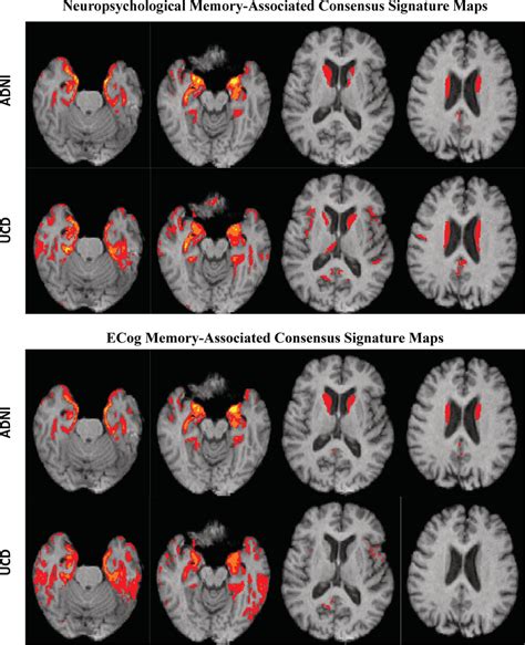 Consensus Signature Tsroi Regions For Memory Top And Ecog Mem