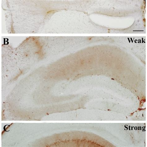 Table A Describes Seizure Behavioral Scoring For Each Racine Scale