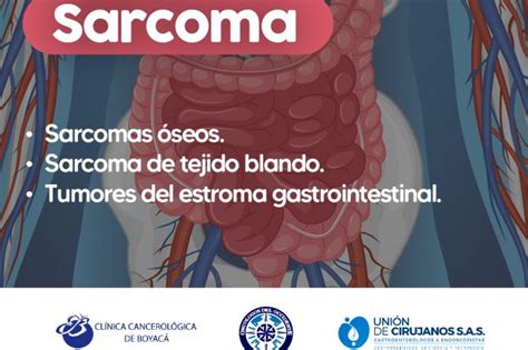 Tipos De Sarcomas • Oncólogos Del Occidente S A S Zentria Tratamientos De Cáncer En Armenia