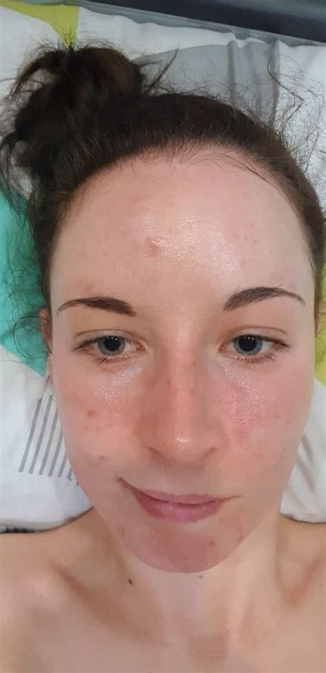 No Makeup And Beautiful 56 Women Share Their Bare Faced Selfies