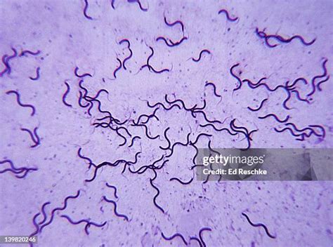 Spirillum Photos And Premium High Res Pictures Getty Images