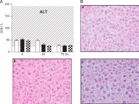 Biochemical And Pathological Analysis Of The Serum And Liver Obtained