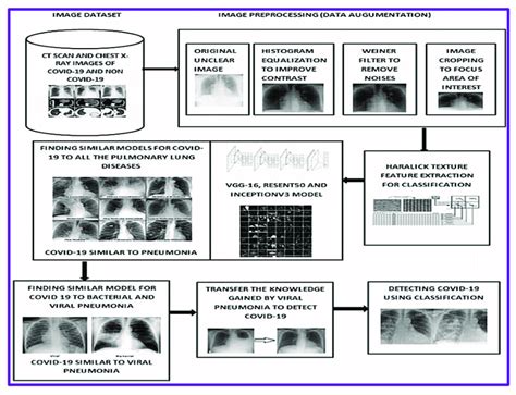 Transfer Learning From Pneumonia Classification Models To Detect