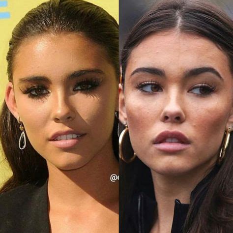 She Is Always Beatiful And Perfect😍💍 Facial Surgery Madison Beer