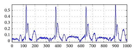 the signals after random sparse mixing download scientific diagram