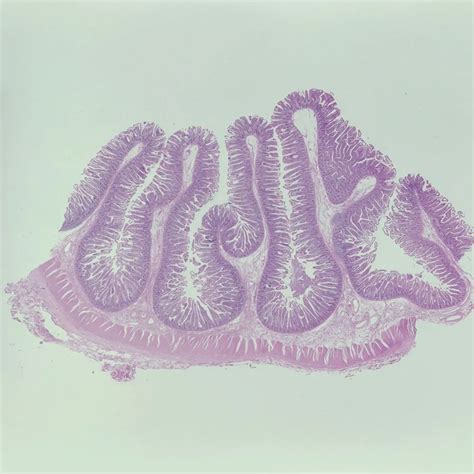 Mammal Jejunum Sec 7 µm Hande Microscope Slide Carolina Biological Supply