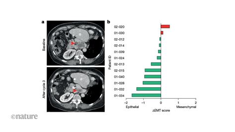 Patrick Mehlen On Linkedin Blockade Of Netrin 1 Is A Promising Strategy Against Endometrial
