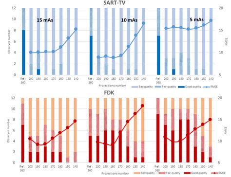 Contribution Of Statistical Iterative Reconstruction Algorithm For