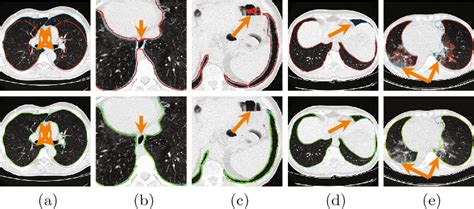 Progressive And Multi Path Holistically Nested Neural Networks For