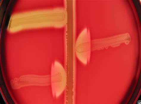 Microbiology L6 Streptococcus Flashcards Quizlet