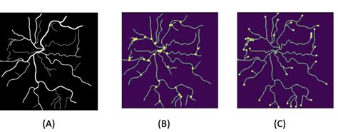 Automatic Detection Of The Particular Points Of A Vascular Network Download Scientific Diagram