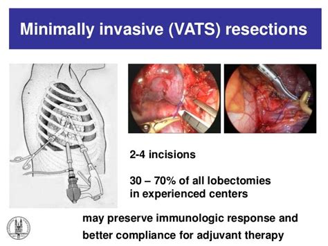 Mon 2011 Slide 22 W Weder Surgery