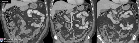 62 Year Old Man With A History Of Malignancy Presenting For