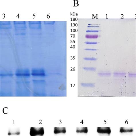 Sds Page And Western Blot Analysis Of Recombinant Il 18 A Sds Page
