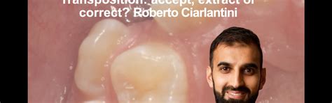 Transposition Accept Extract Or Correct Roberto Ciarlantini Episode 64 November 25th 2020