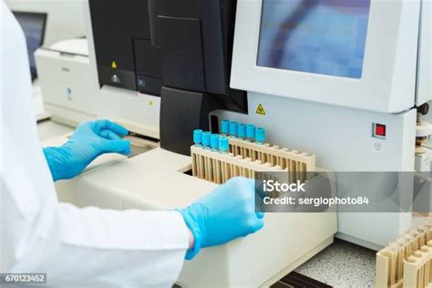 실험실 조 수 응고 시험 분석에 대 한 샘플 튜브를 로드의 손에 건강 검진에 대한 스톡 사진 및 기타 이미지 건강 검진 혈액응고 Stem 주제 Istock