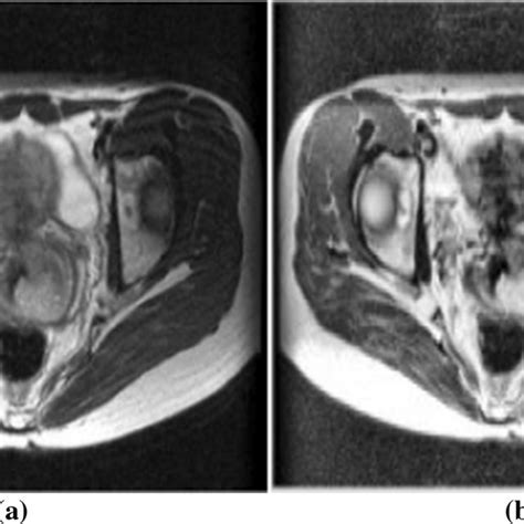 The Output Of Intensity Enhancement A Before Enhancement B After Download Scientific Diagram