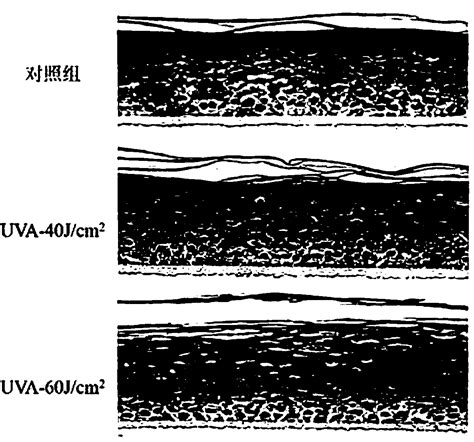 Phototoxicity Detection Method Based On Recombinant Skin Model Eureka Patsnap