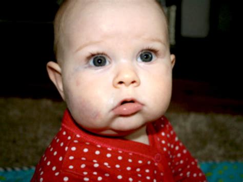 Cute Birthmark