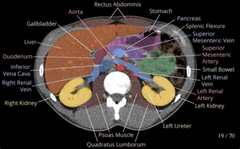 Ct And Cross Sectional Anatomy Exam 2 During Class Flashcards Quizlet