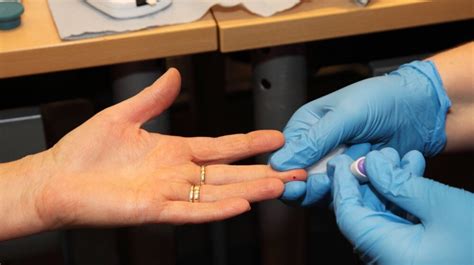 Znaci Koji Pokazuju Da Imate Visok Holesterol U Krvi Život Dnevni List Danas