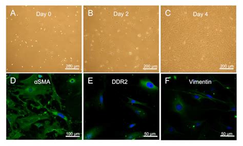Ultrasonic Augmented Primary Adult Fibroblast Isolation Protocol