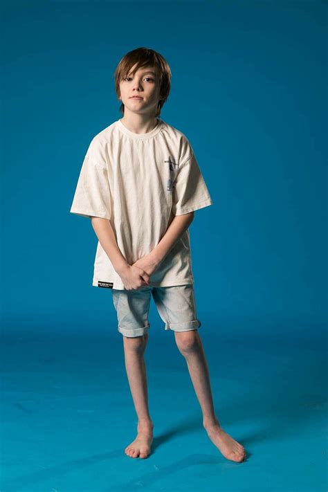 Jayden R Zbd Talent Models With Disabilities Visible Differences And Trans And Non Binary