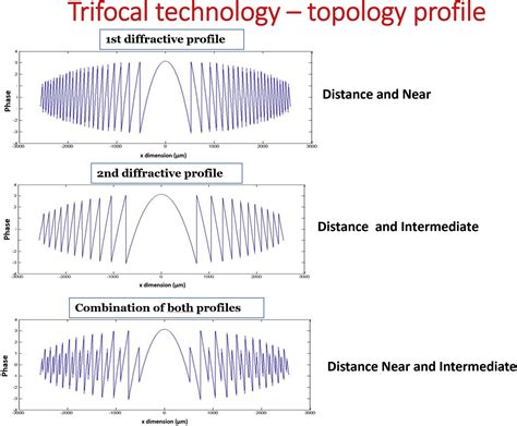 Multifocal And Extended Depth Of Focus Intraocular Lenses In 2020