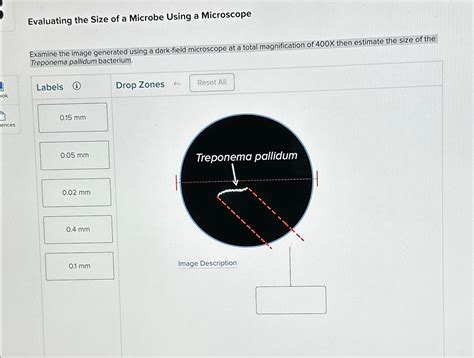 Solved Evaluating The Size Of A Microbe Using A Chegg