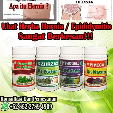 Jual Ubat Angin Pasang Turun Berok Sangat Berkesan Ejen Ubat Herba