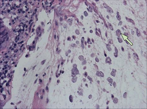 Entamoeba Histolytica Slide