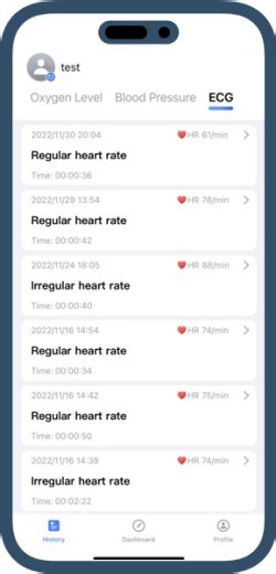 Compact Portable Mobile Ecg Monitoring Solution Viatom
