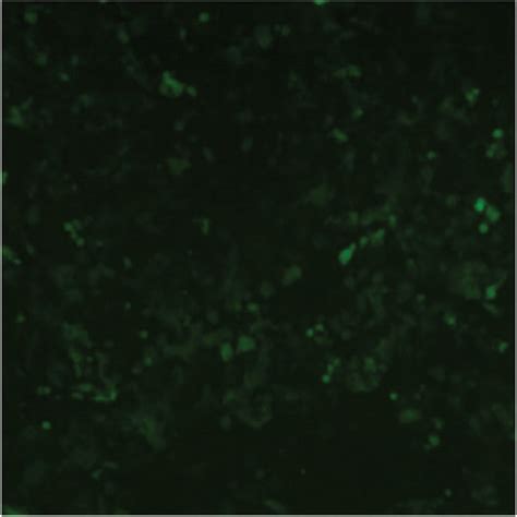 A Illustrates The Ns Group B Depicts The Tnfaip3 Group In Both Download Scientific