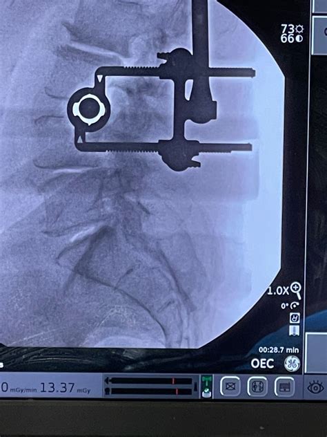 Patrick Kelley Ii On Linkedin Atec Ltp Chs