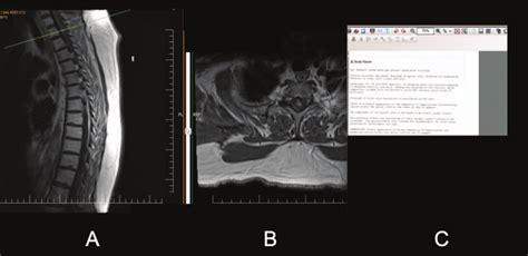 A Sagittal And B Axial Contrast Enhanced Magnetic Resonance Image