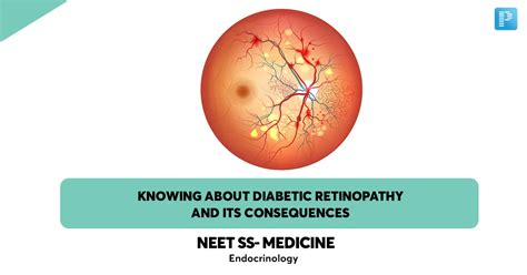 Diabetic Retinopathy And Its Consequences Prepladder