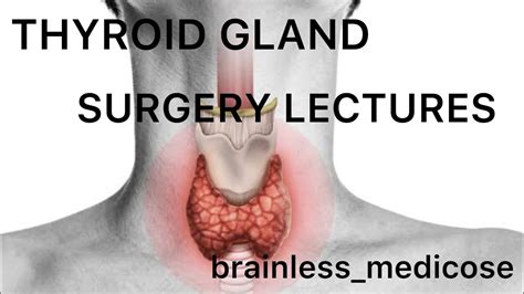 Thyroidectomy Thyroid Surgery Lectures Part 15 Thyroidectomy Thyroidgland Youtube