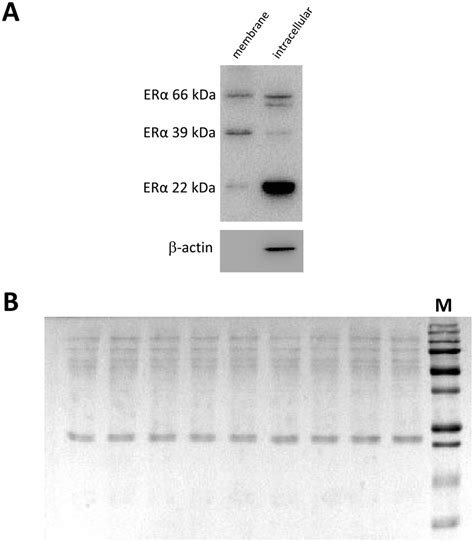 Cell Surface Biotinylation Of Anterior Pituitary Cells Cultured