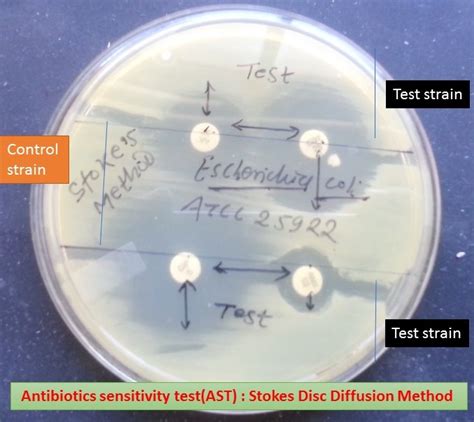 Stokes Disc Diffusion Method Introduction Principle Procedure And Resu