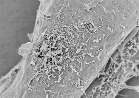 Scanning Electron Microscope Virus