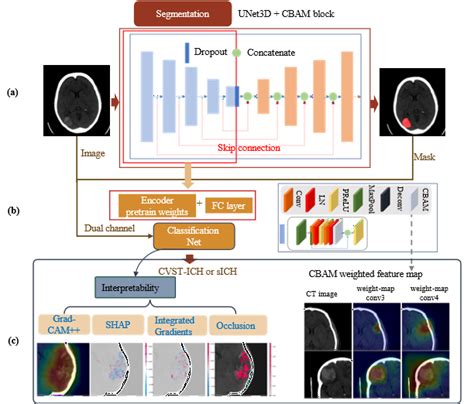 首个基于深度学习的脑静脉系统相关脑出血诊断研究获突破—新闻—科学网