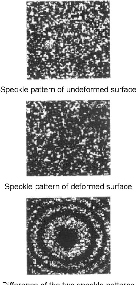 Figure 1 From The Use Of Electronic Speckle Pattern Interferometry For